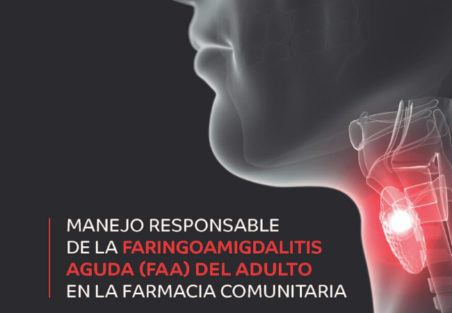 SEFAC avala una guía sobre el manejo de la faringoamigdalitis